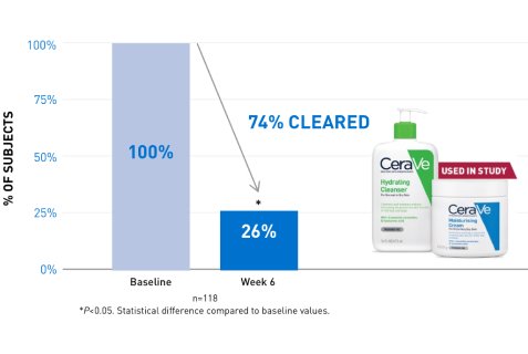 Atopic Dermatitis CeraVe | L'Oreal Dermatological Beauty Pro