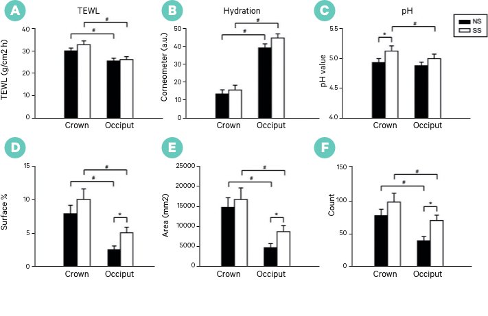 Sensitive scalp is associated with excessive sebum and perturbed microbiome | L'Oréal ...