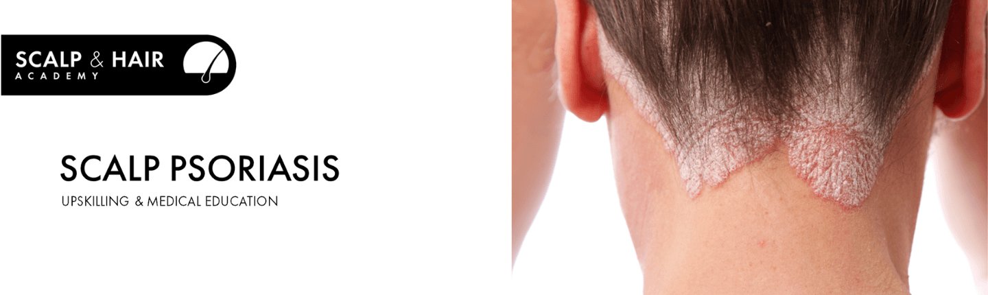 Dercos Academy Scalp Psoriasis